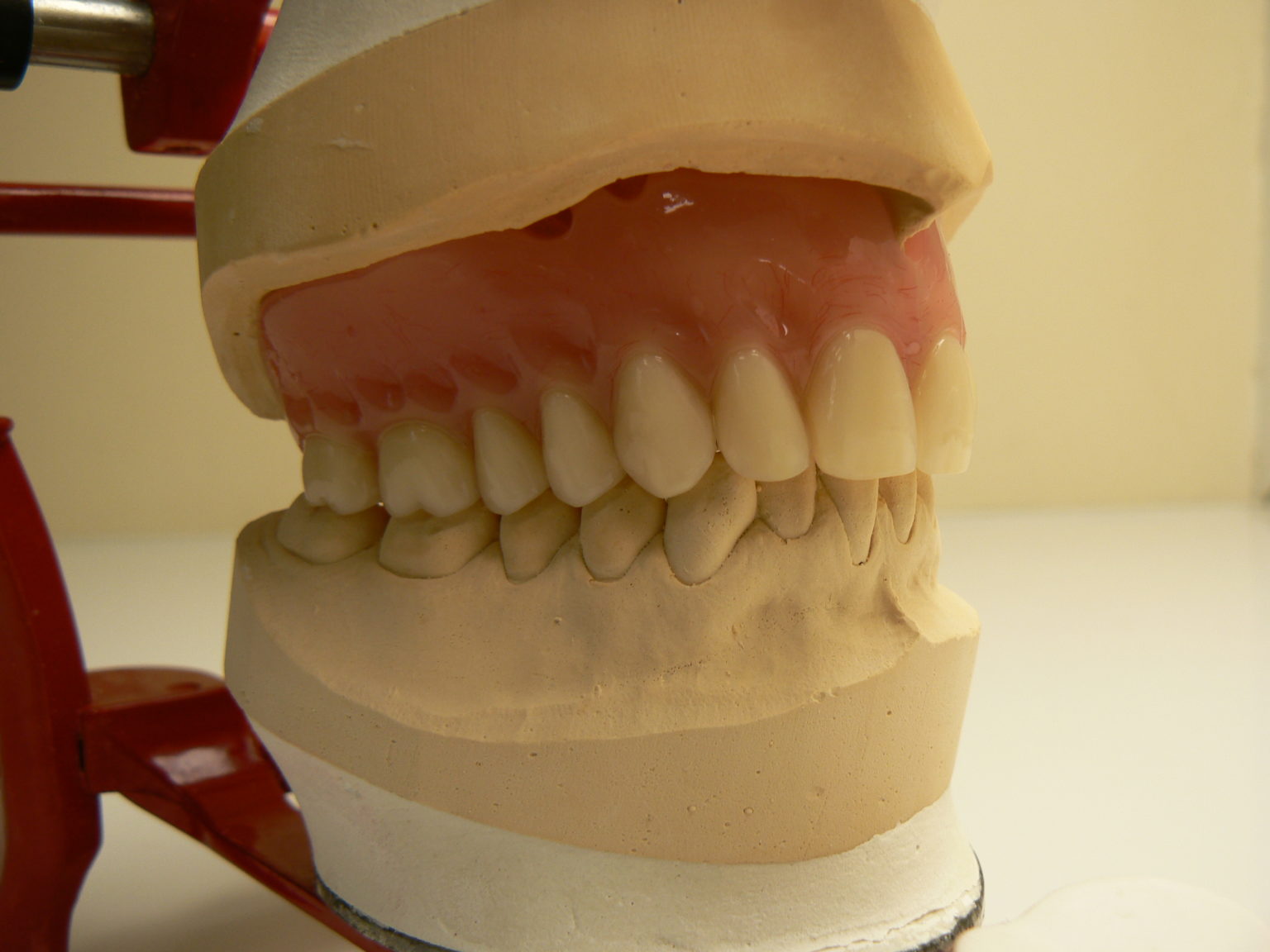 Prothèse résine PERForm – PN Prothèse