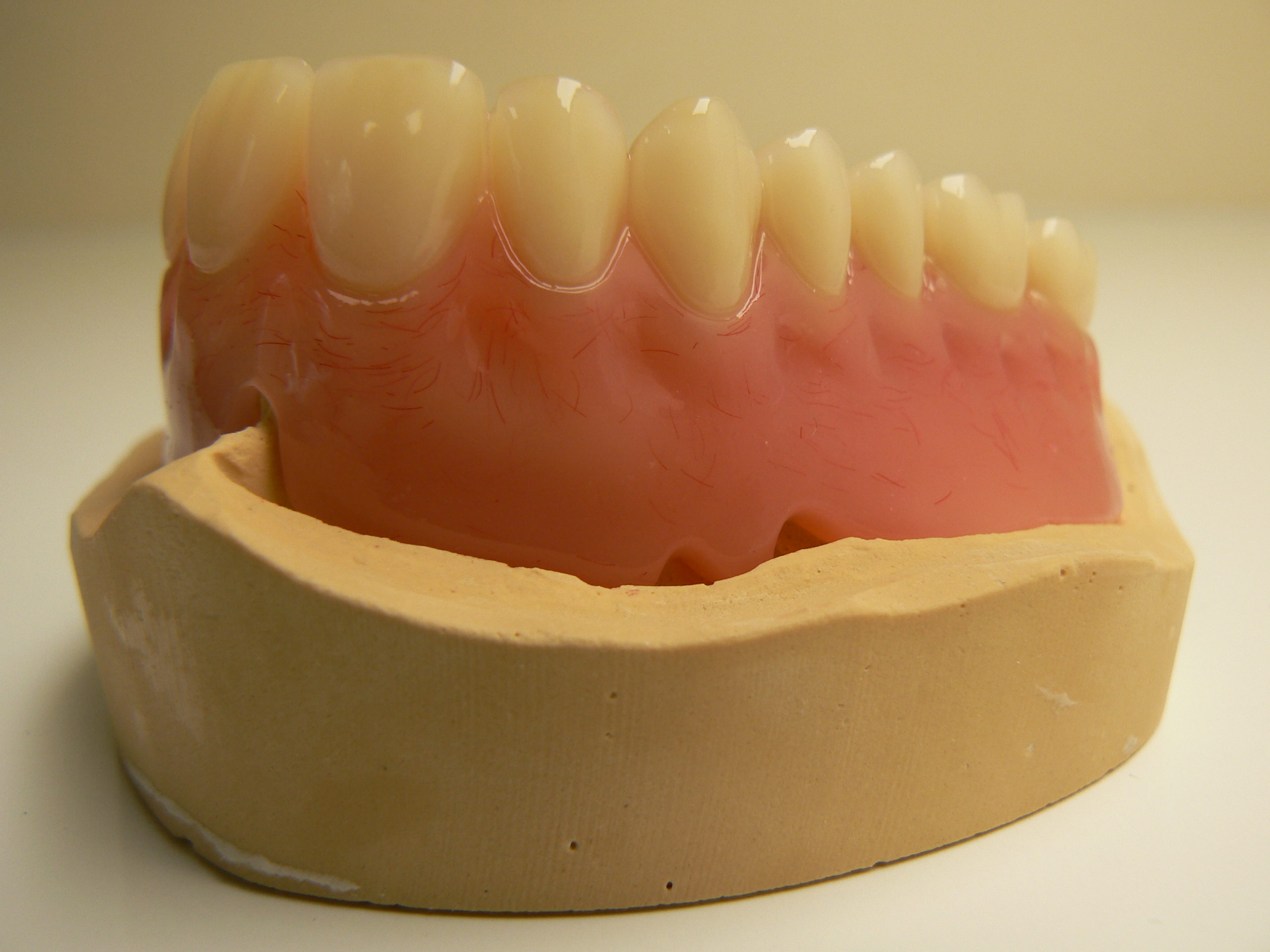 Prothèse résine PERForm – PN Prothèse