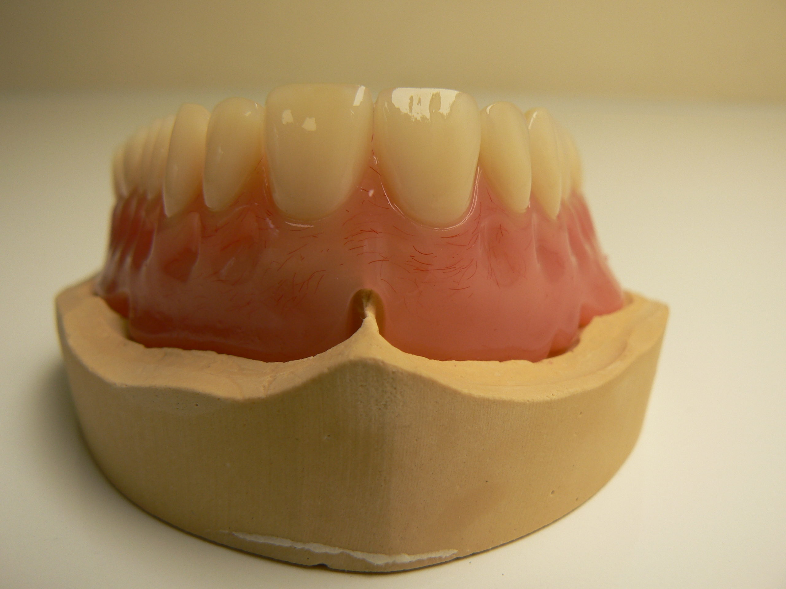 Prothèse résine PERForm – PN Prothèse