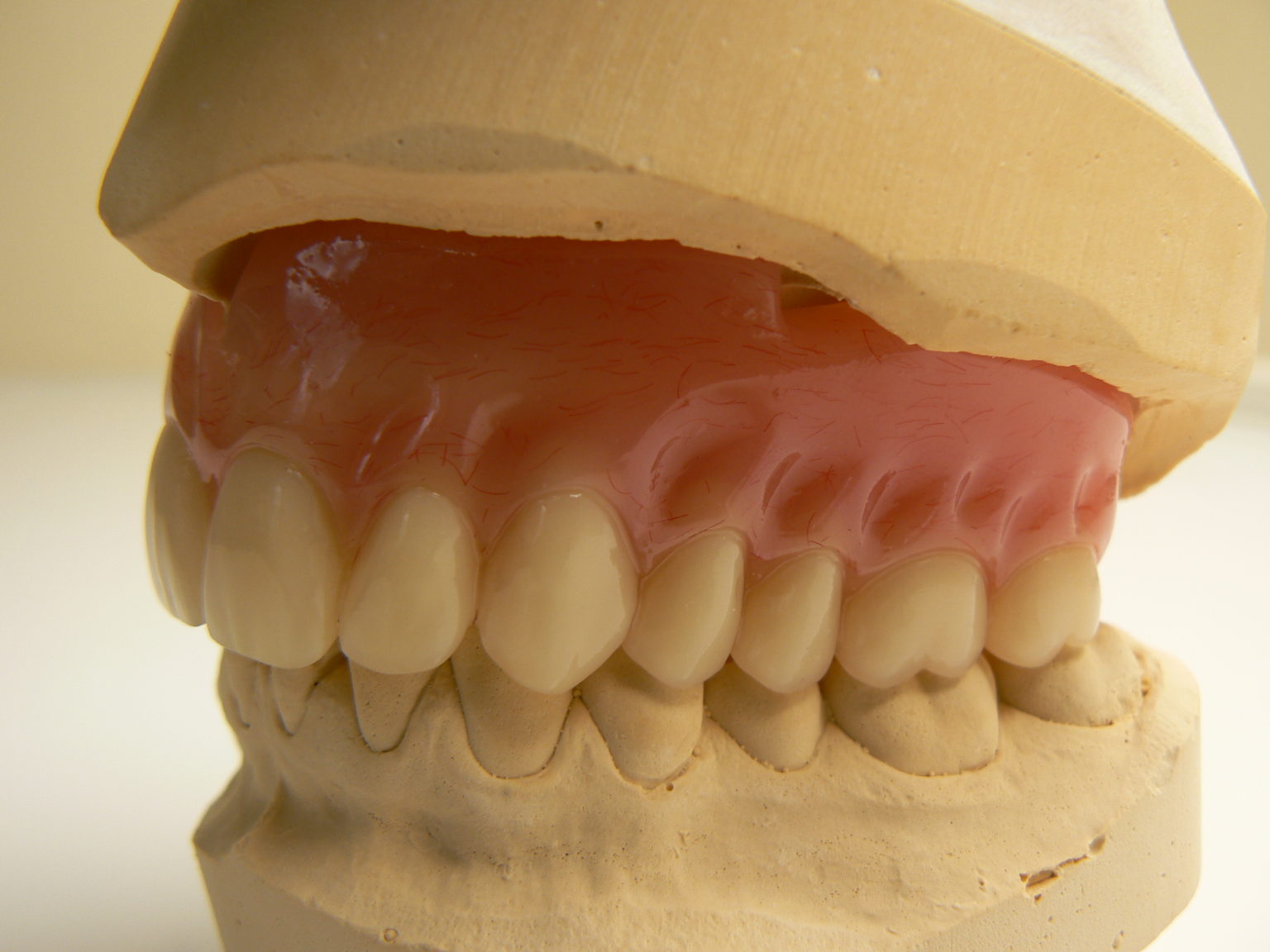 Prothèse résine PERForm – PN Prothèse