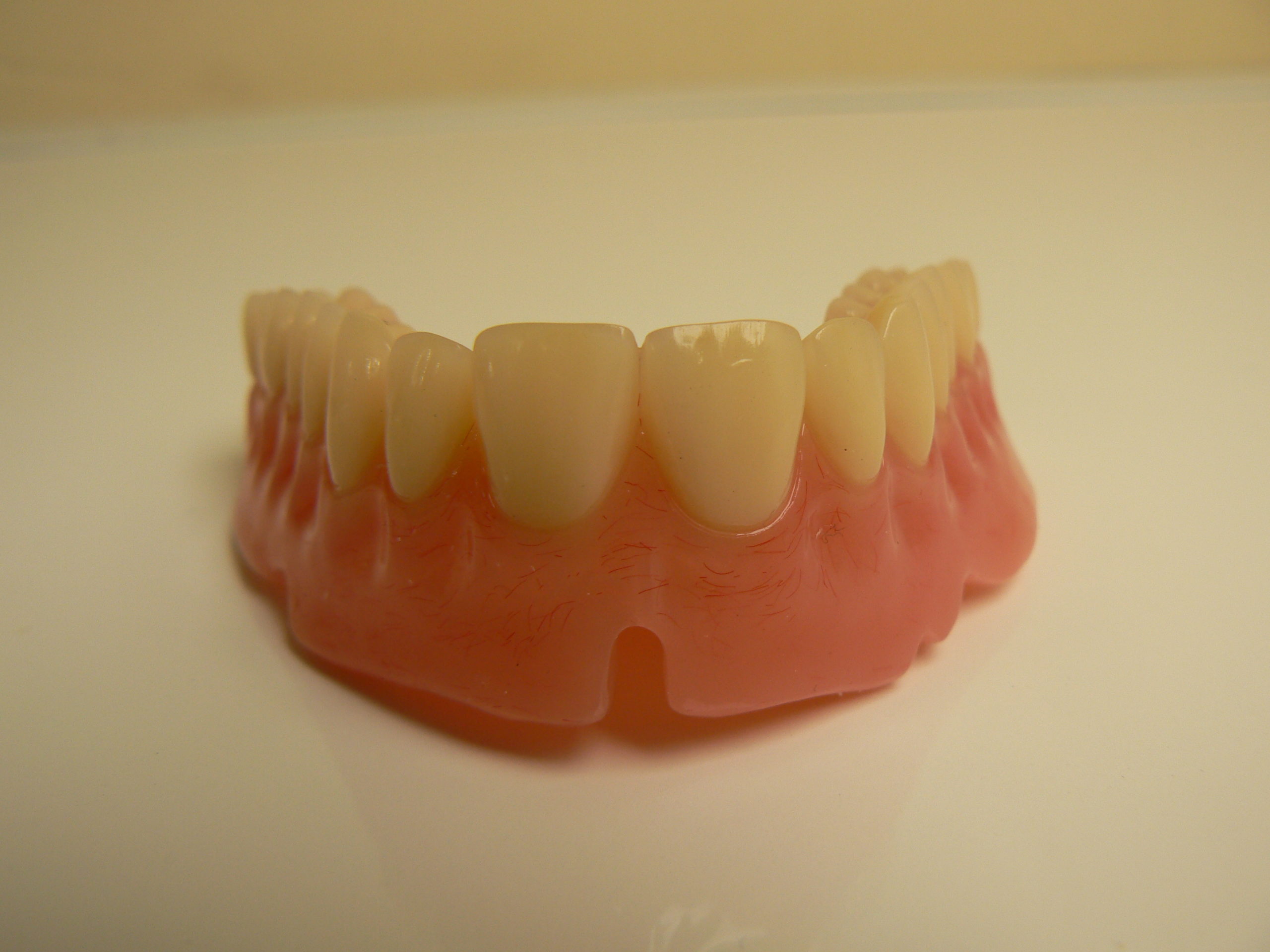 Prothèse résine PERForm – PN Prothèse