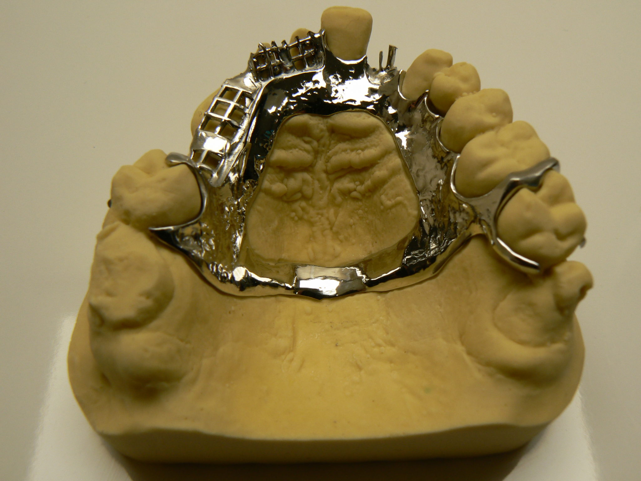 Stéllite – PN Prothèse